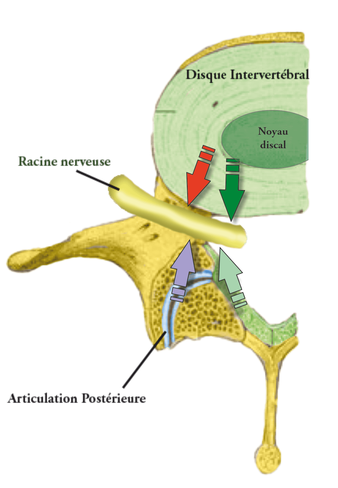 La Sciatique - TENENHAUS Jean-Marc Ostéopathe D.O.